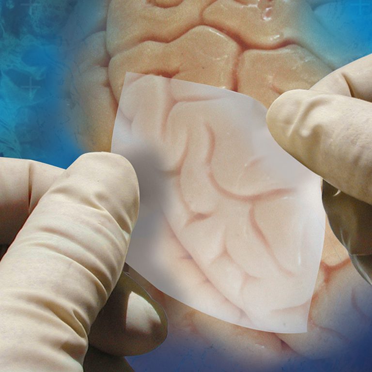 PYRAMESH – OmegaMed Sureste